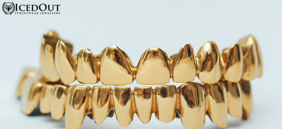 How Much Are Grillz? Cost Guide for Gold & Diamond – IcedOut
