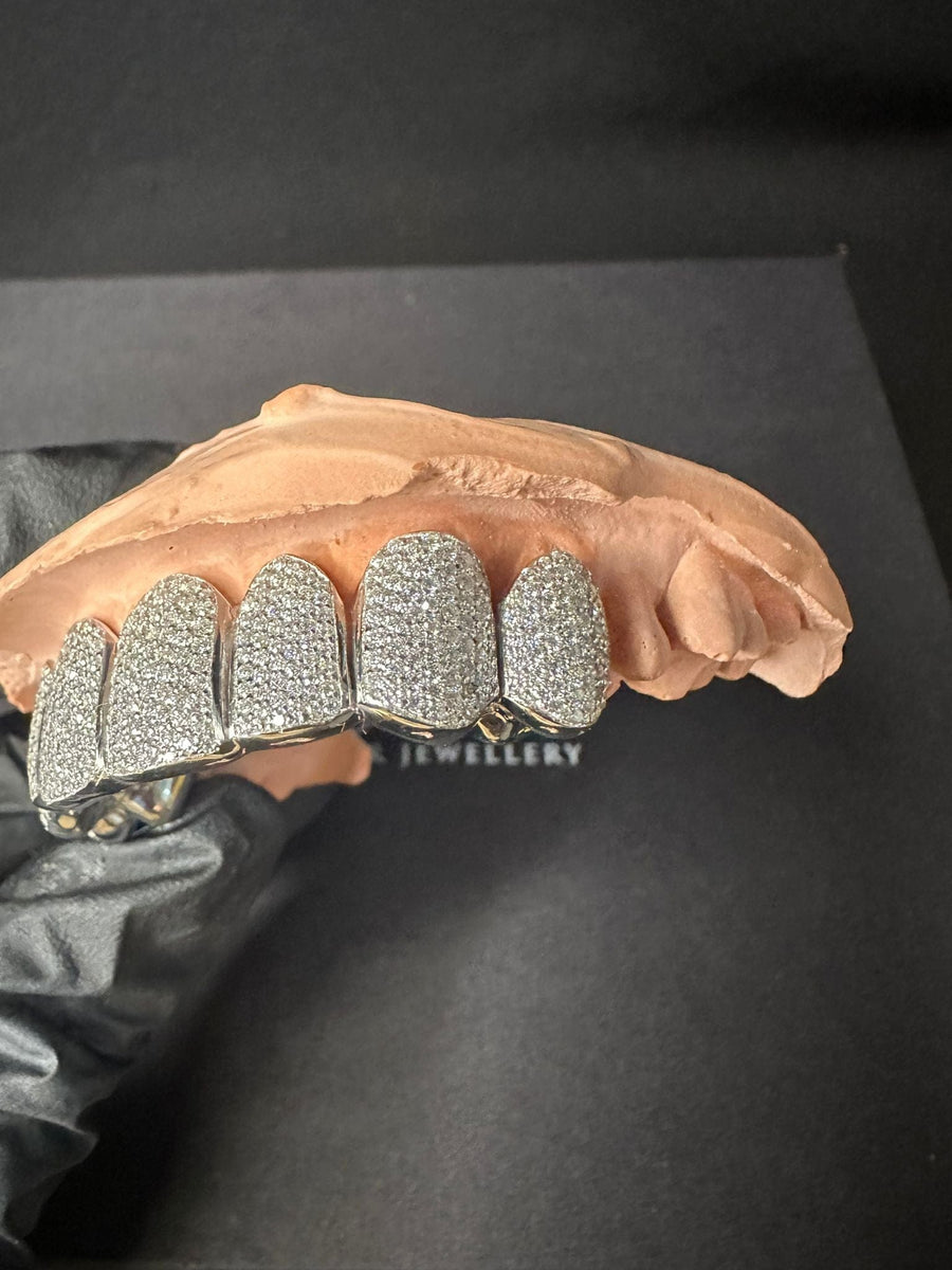 Custom VVS Grillz 8 Top – icedoutnz